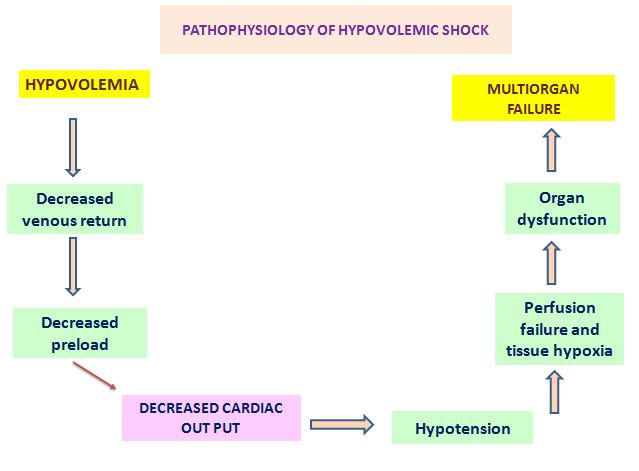 Hypovolemic Shock Histopathologyguru
