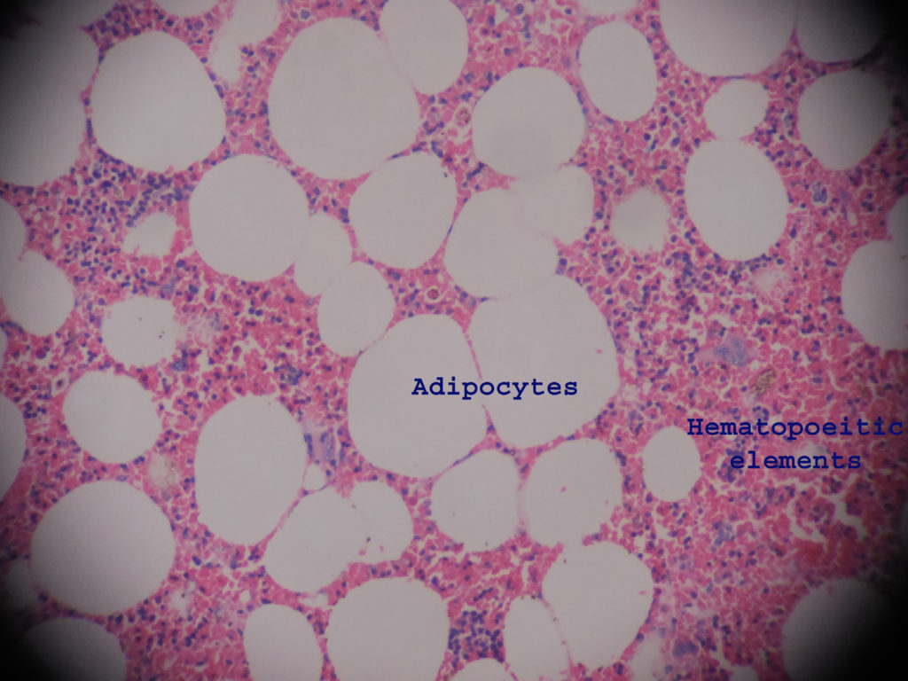 Adrenal myelolipoma – Histopathology.guru