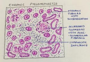 Chronic pyelonephritis. – Histopathology.guru