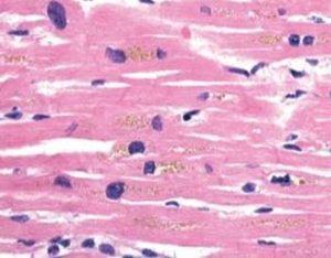 Lipofuscin – Histopathology.guru